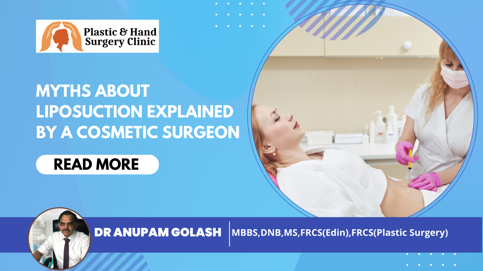 5 myths about liposuction explained by a cosmetic surgeon