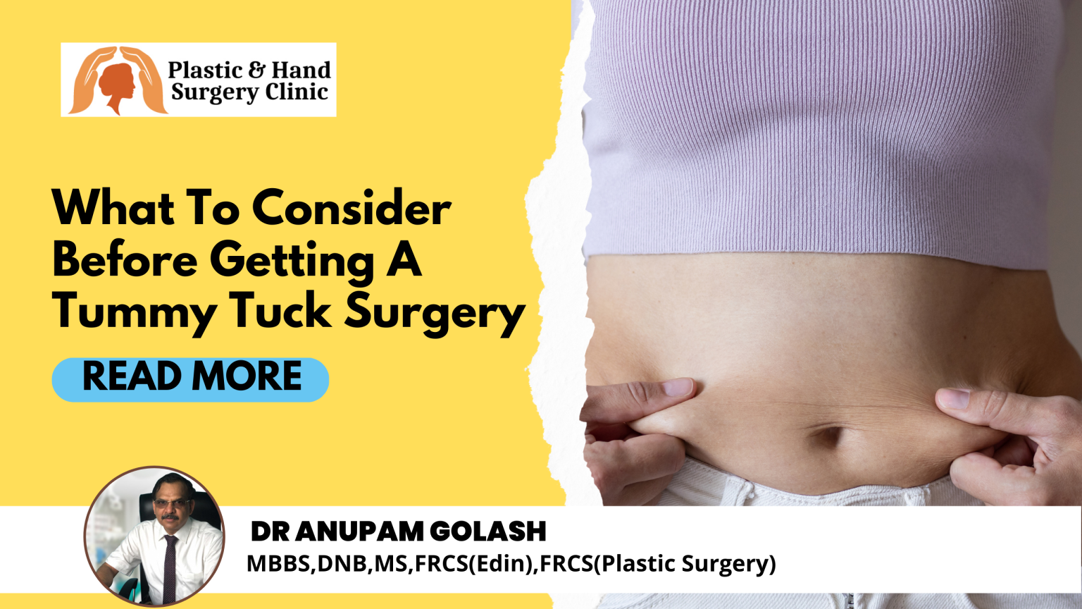 What To Consider Before Getting A Tummy Tuck Surgery