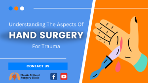 Understanding The Aspects Of Hand Surgery For Trauma