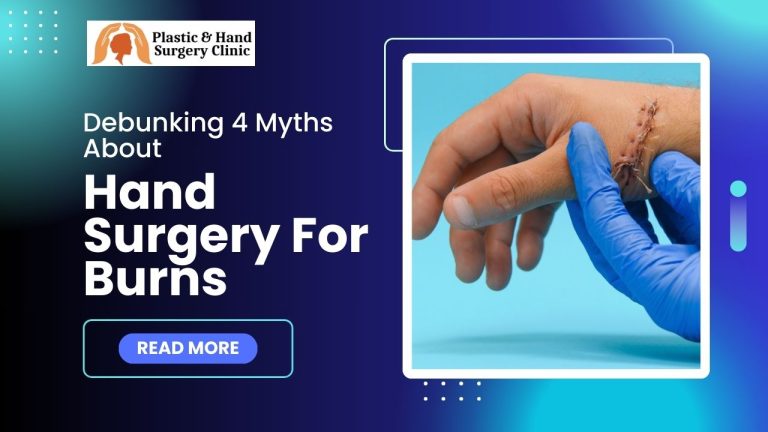 Debunking 4 Myths About Hand Surgery For Burns