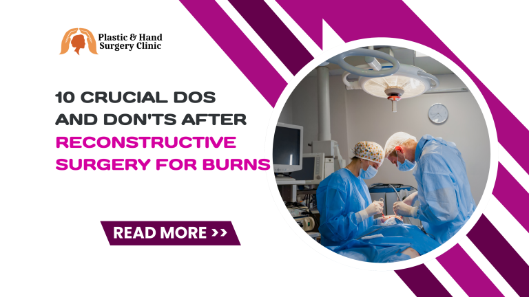 10 Crucial Dos and Don'ts After Reconstructive Surgery for Burns