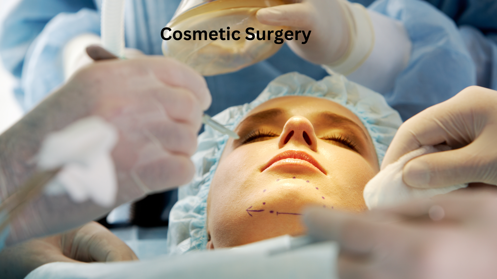 5 Fun Facts About Cosmetic Surgery You Must Know!