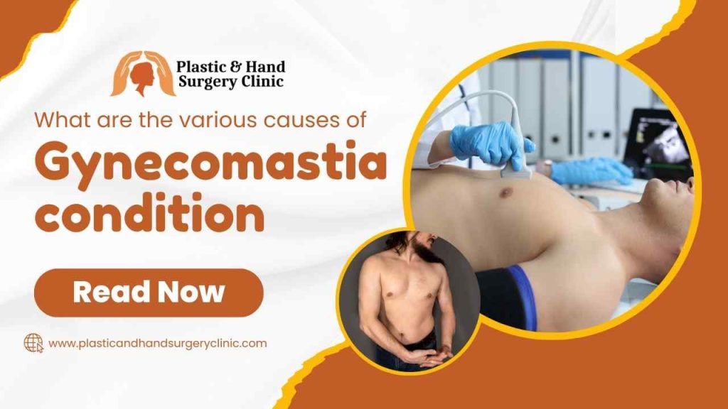 What are the various causes of gynecomastia condition?